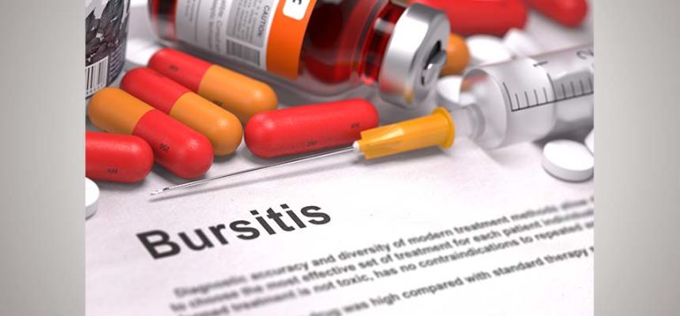 Bursitis Fisioterapia Talavera Martín Vasco
