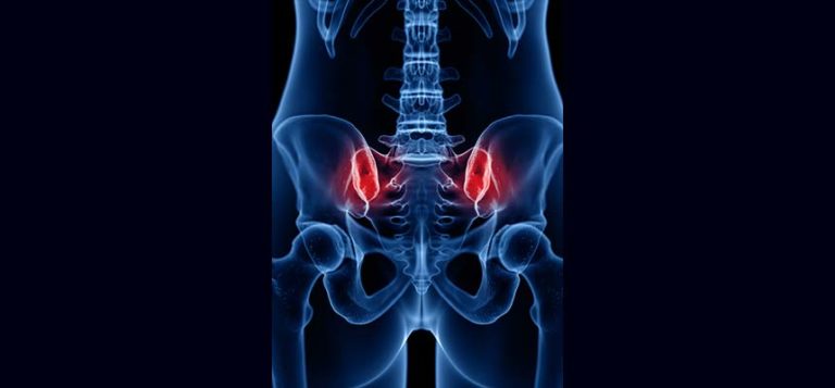 Dolor sacroiliaco o sacroileitis - Fisioterapia Talavera Martín Vasco