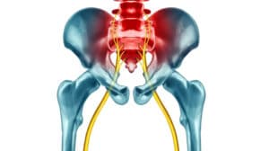 ¿Cuál es el mejor tratamiento para la ciática? - Fisioterapia Talavera ...